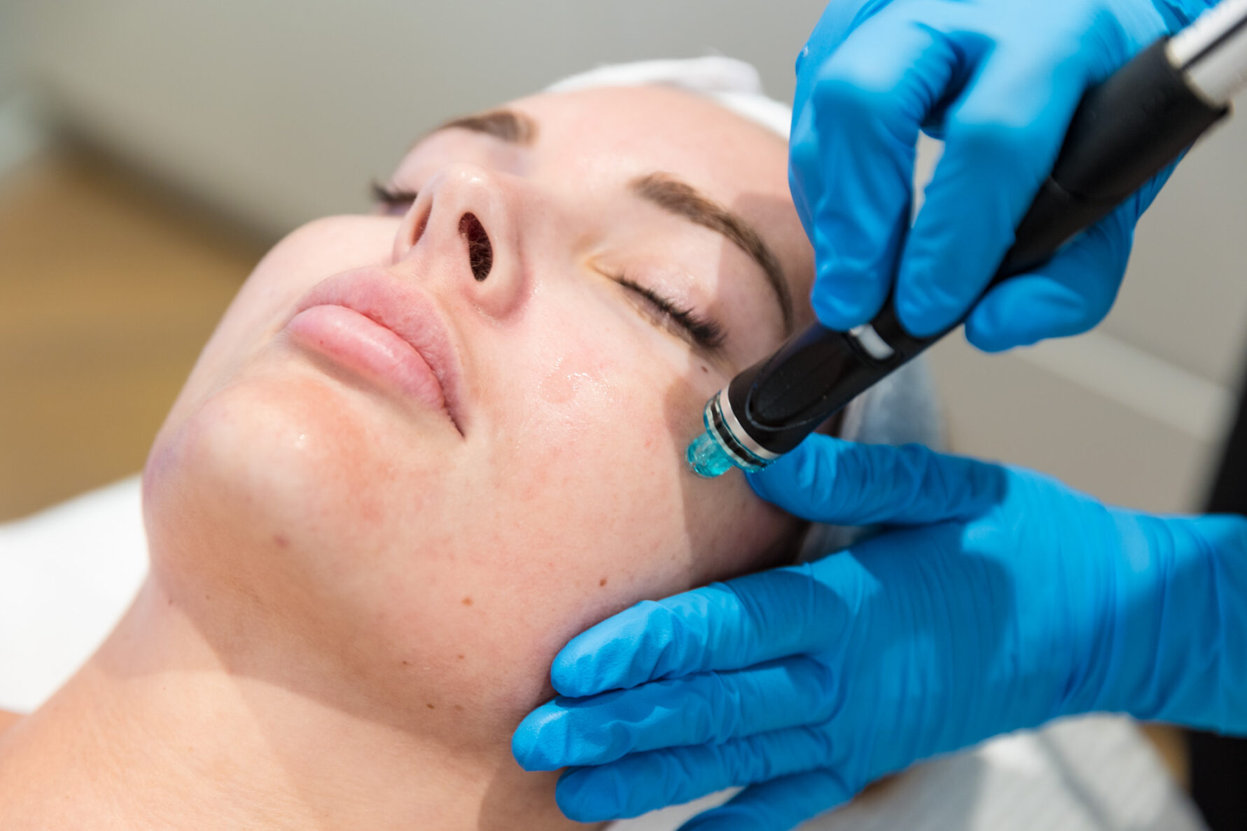 HydraFacial in Silverdale | Kate Allen Aesthetics