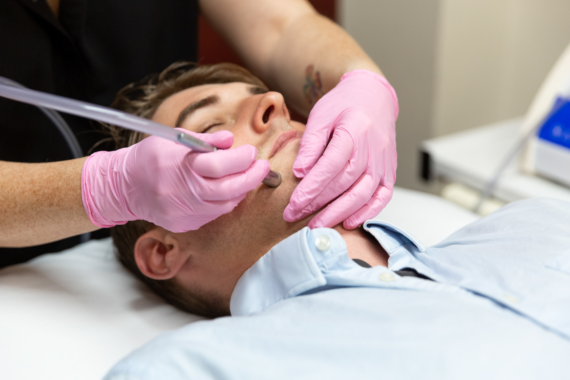 Microdermabrasion in Silverdale | Kate Allen Aesthetics