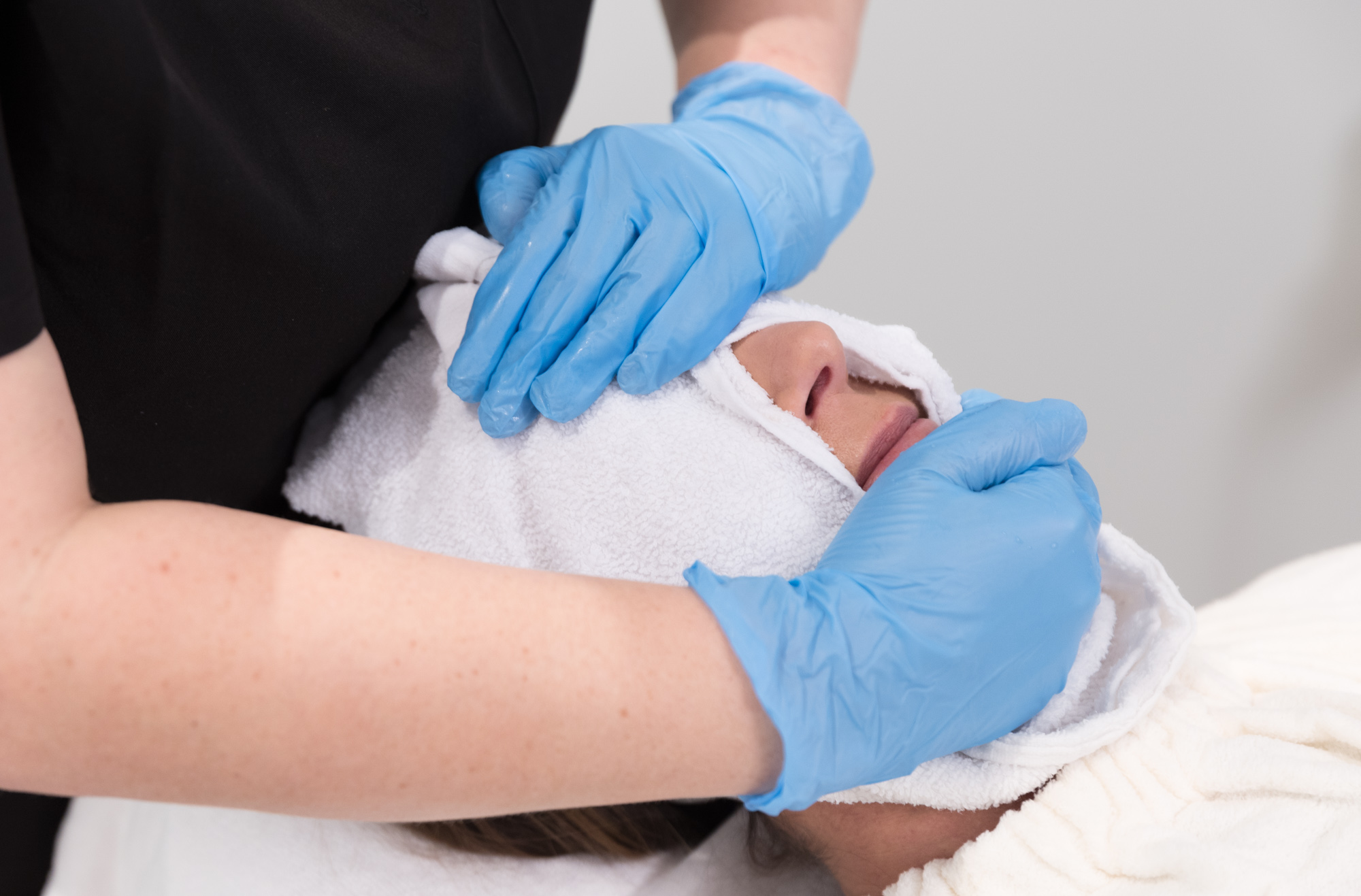 Laser Rejuvenation Therapy in Silverdale | Kate Allen Aesthetics